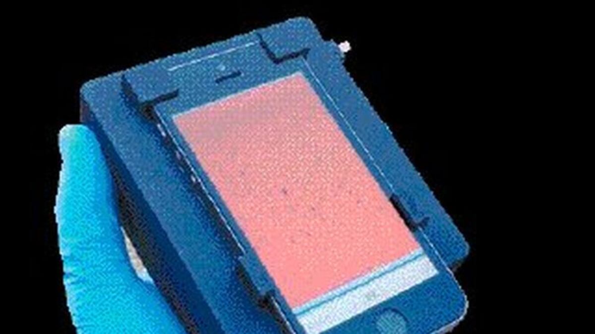 ‘CellScope Loa’ podría ayudar a eliminar enfermedades | La Prensa Panamá